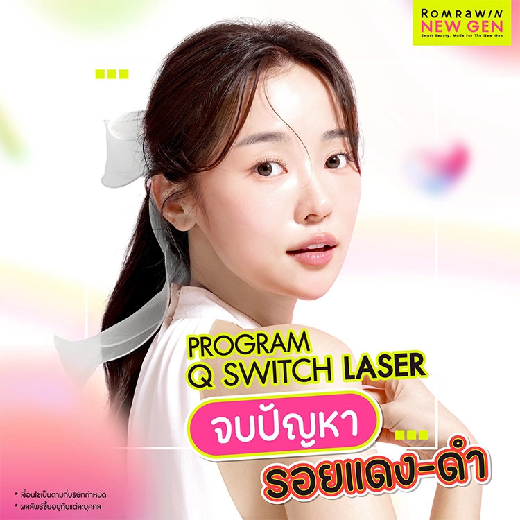 Q Switch Laser คืออะไร ทำกี่ครั้งเห็นผล รักษาปัญหาผิวอะไรได้บ้าง
